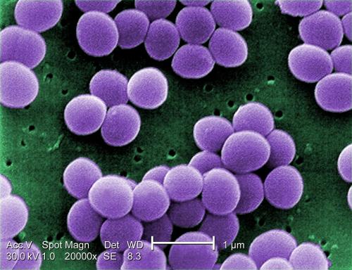 Bacterial memory could be the missing key to beating life threatening ...