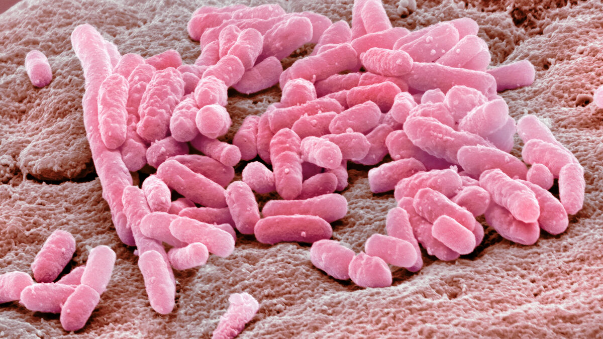 Une centaine de touristes victimes d’intoxication alimentaire dans un ...