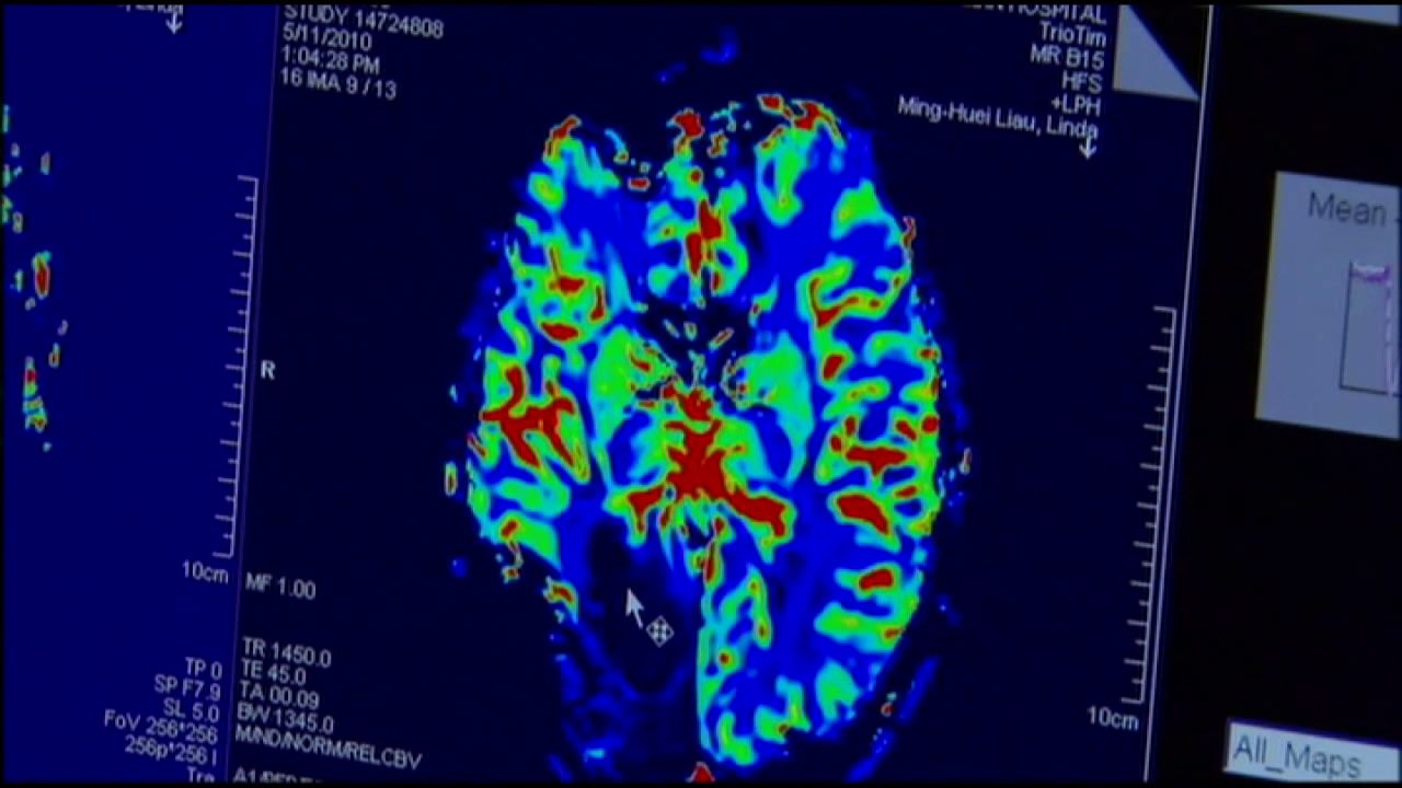 New FDA-approved pill offers hope for rare, deadly brain cancer