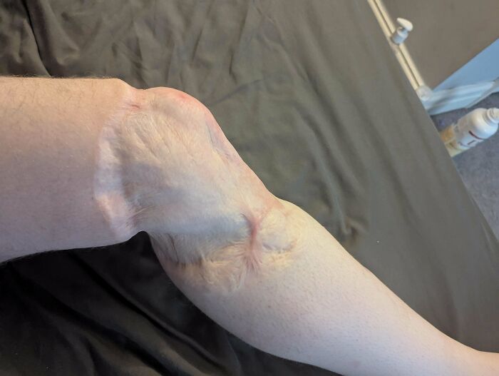 38 People Proudly Show Their Most Distinctive Features That Make Them ...