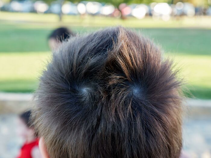 38 People Proudly Show Their Most Distinctive Features That Make Them ...