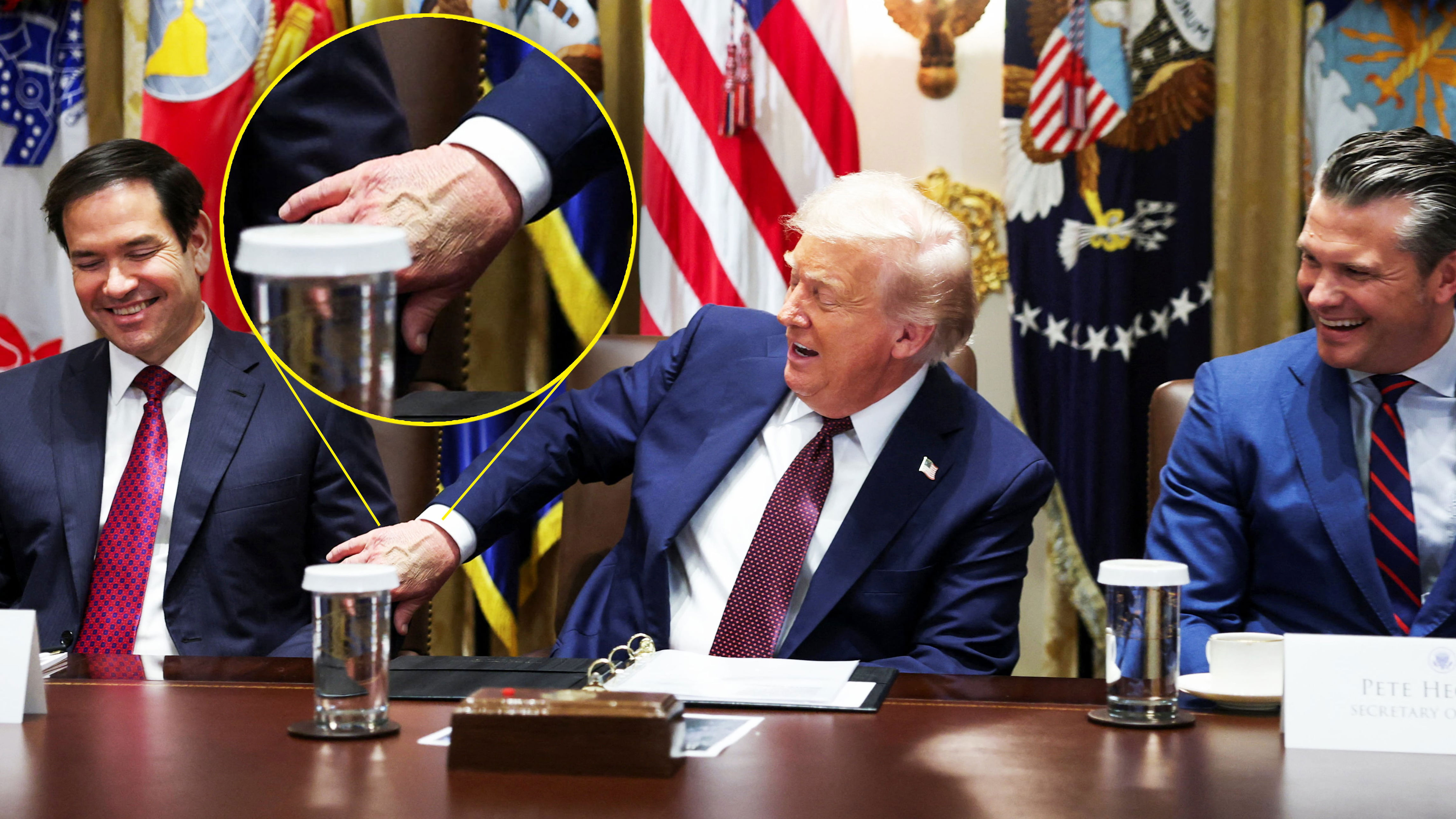 Trump Botches Attempt to Cover Up His Heavily Bruised Hand