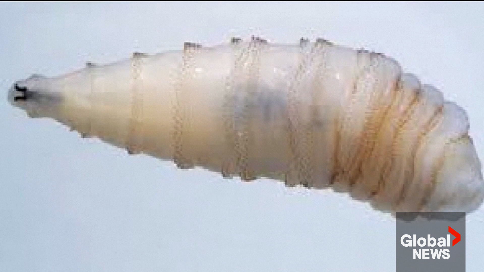 1st human case of flesh-eating screwworm parasite confirmed in U.S.