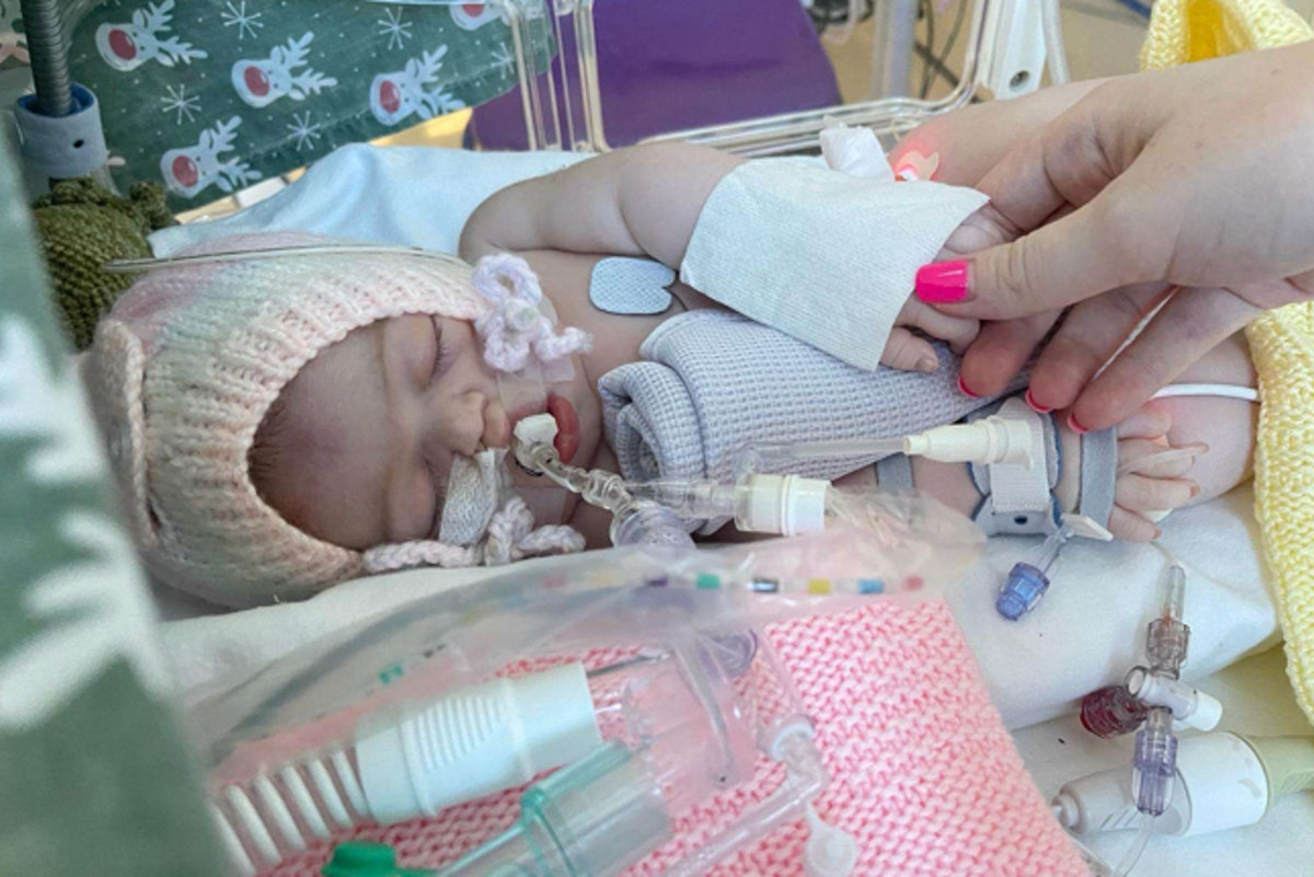Lab-grown mini-lungs used to test new treatment for rare condition in ...
