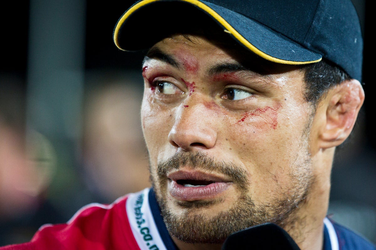 Rugby player Shane Christie, who called for study of concussion, dies ...
