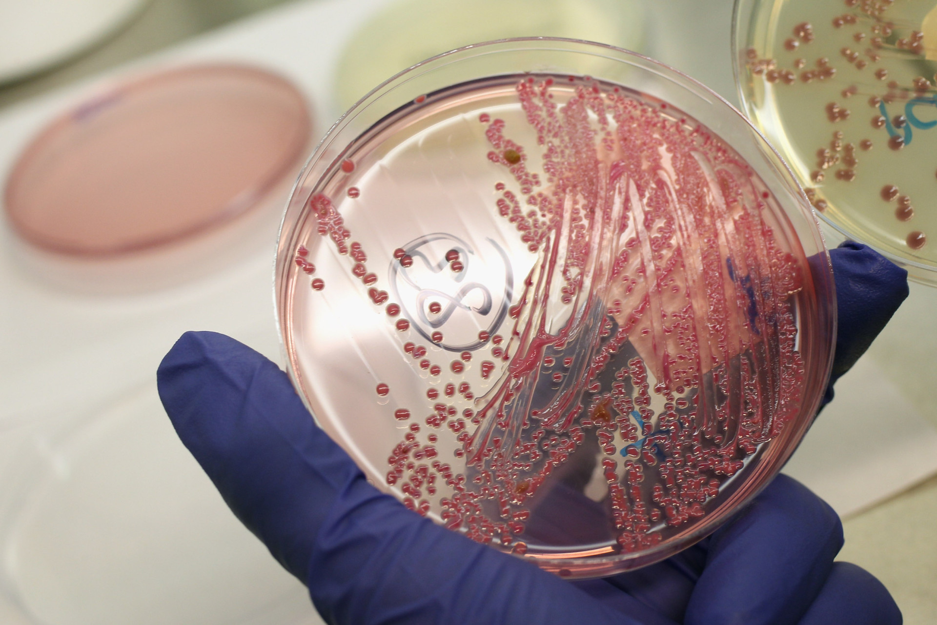 How dangerous is E. coli? What you need to know