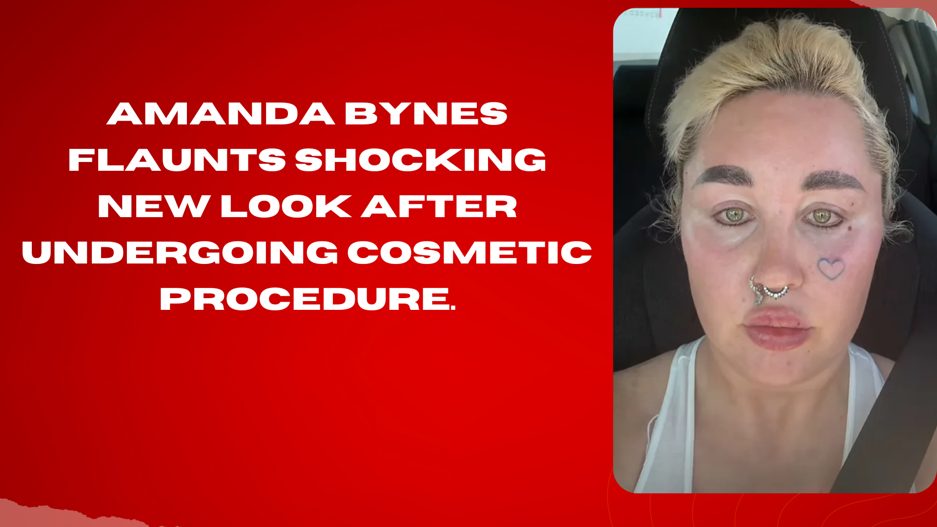 Amanda Bynes Flaunts Shocking New Look After Undergoing Cosmetic Procedure.
