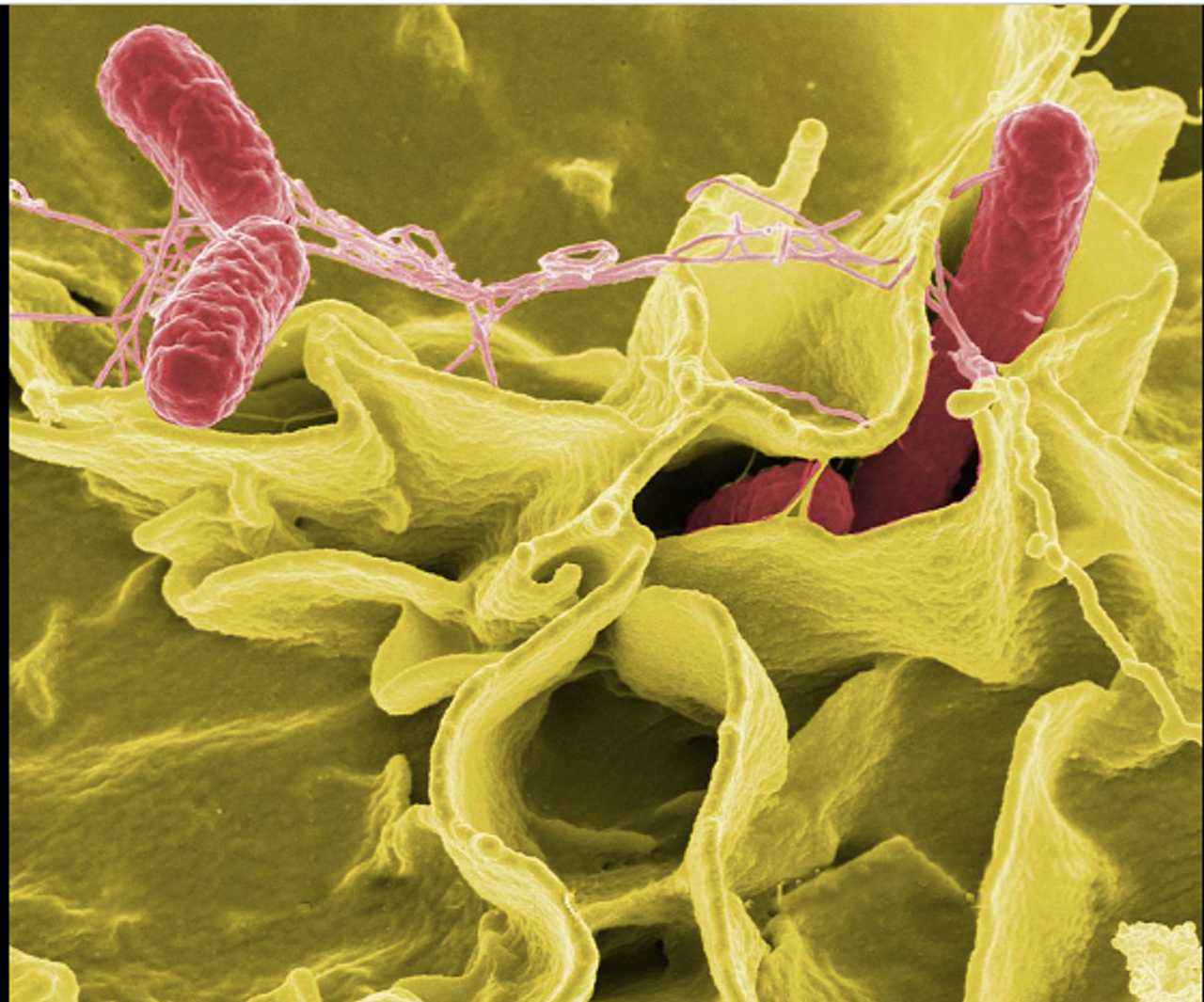 CDC Reportedly Reduces Scope Of Foodborne Illness Tracking