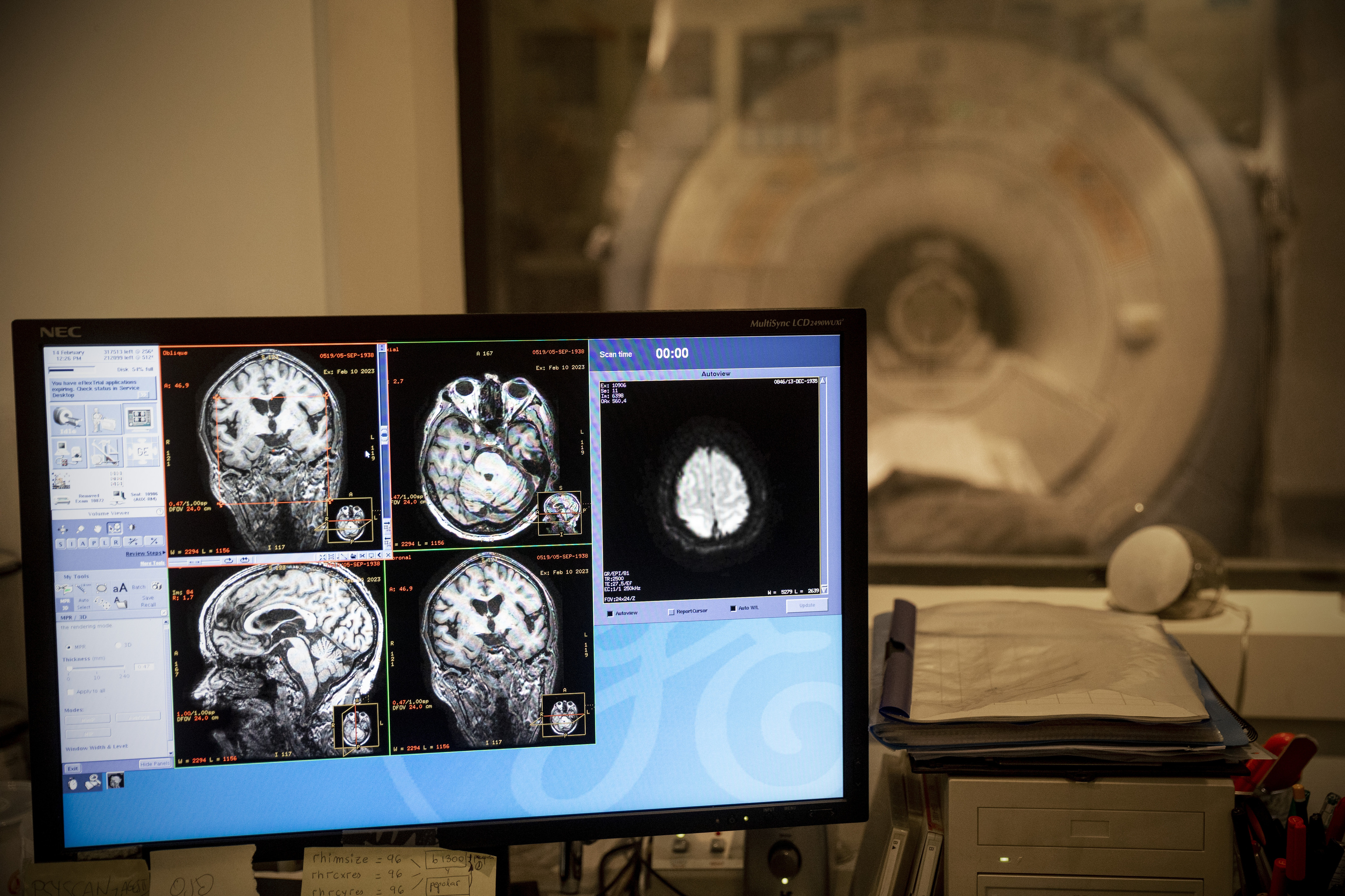 En España se diagnosticarán más de 300.000 casos de cáncer en 2026: los ...