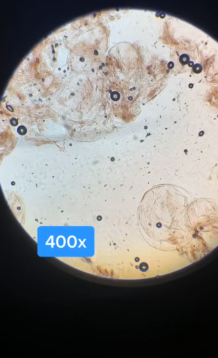 Mind-Blowing Microscope Views You Have to See to Believe!