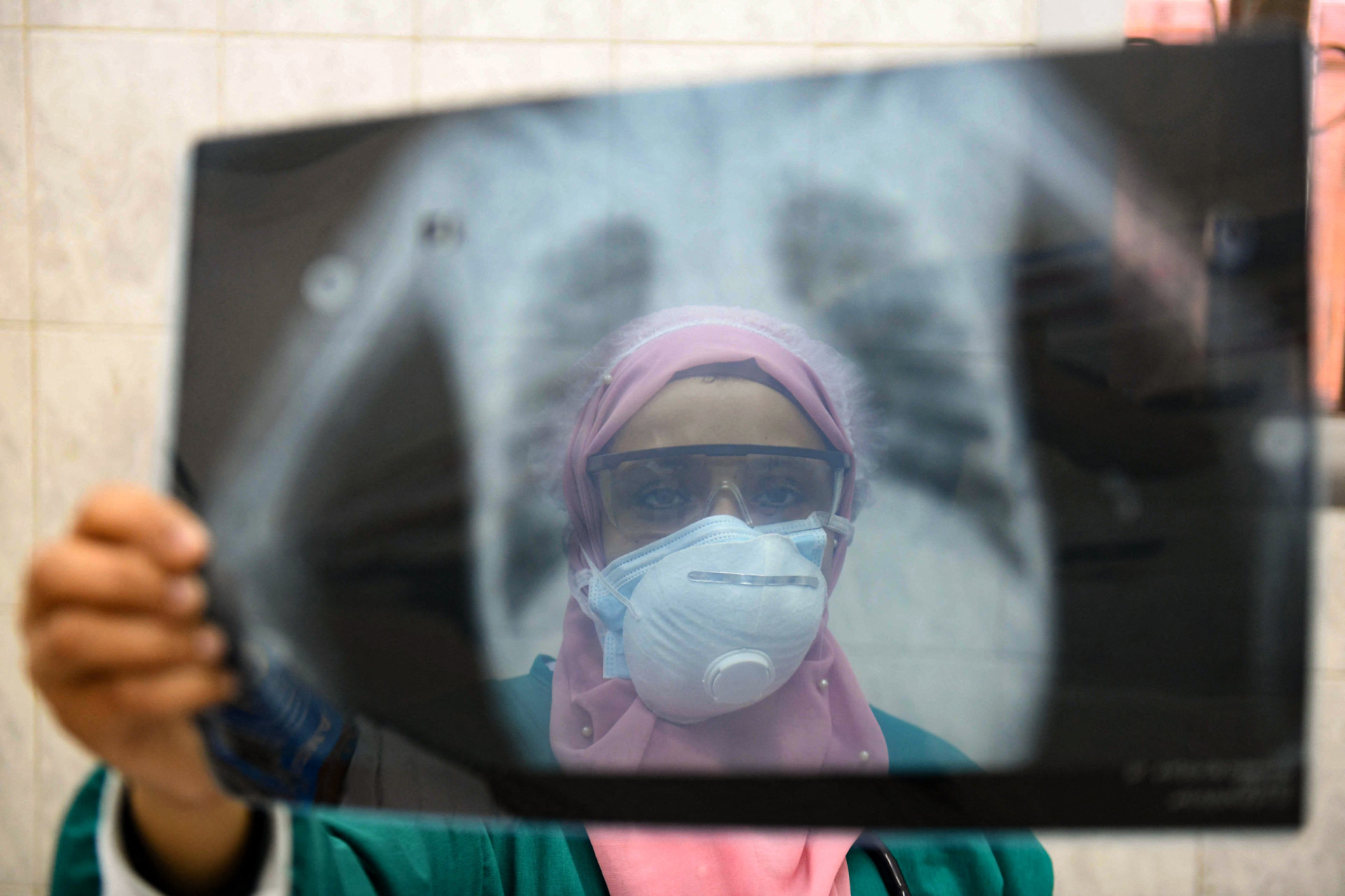 Everything you need to know about lung cancer