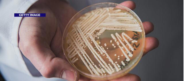 Infections involving ‘superbug’ fungus persisting in Nevada, data shows