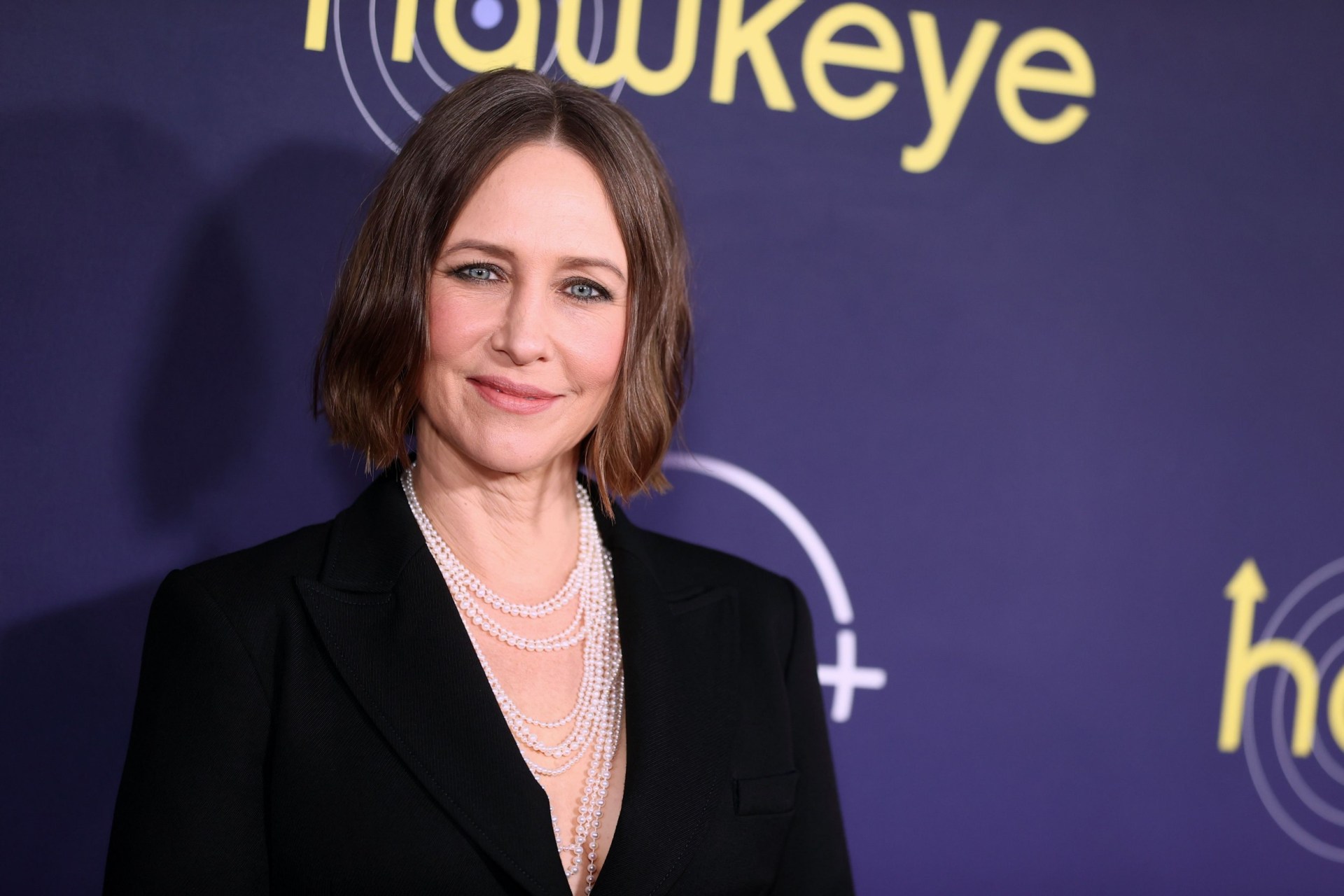 The Conjuring actress reveals 'inexplicable' bruises