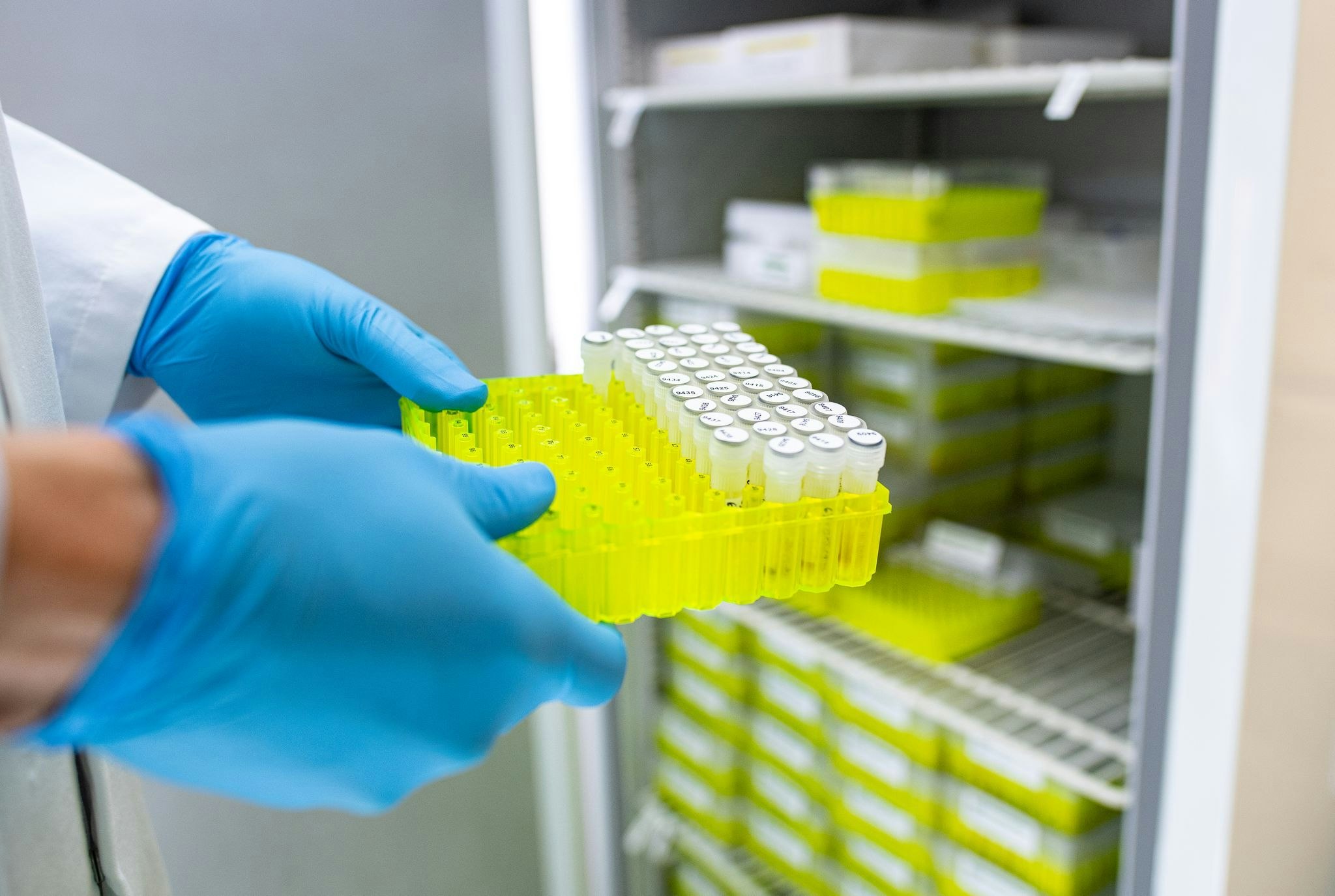 Infektionskrankheit: Ehec: Inzwischen zehn Kinder und zwei Erwachsene ...