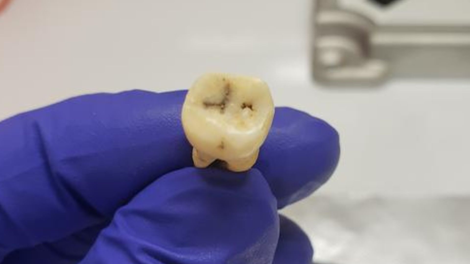 Ancient DNA solves 1,500-year-old mystery that caused ‘world’s first ...