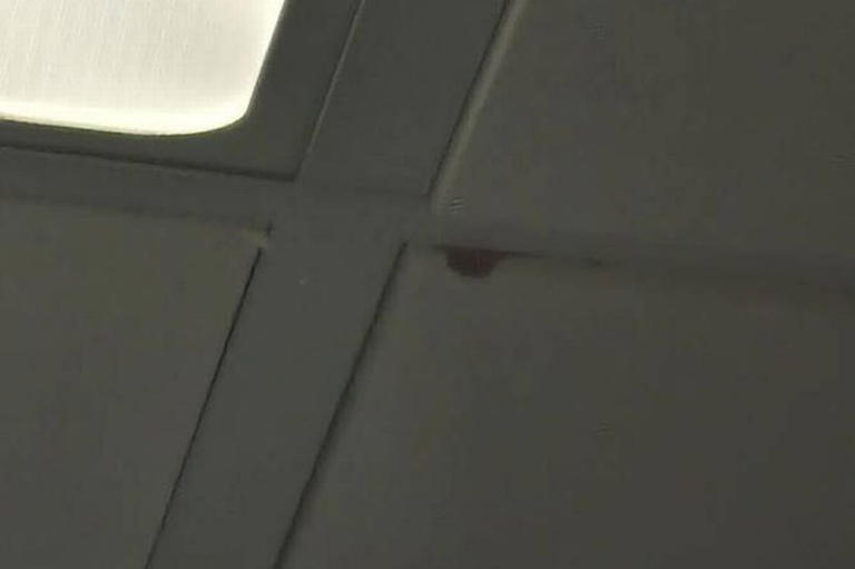 'Disgusting' pictures show blood dripping from ceiling of hospital