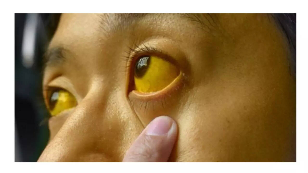 5 signs that scream Vitamin B12 deficiency (and why it is dangerous)