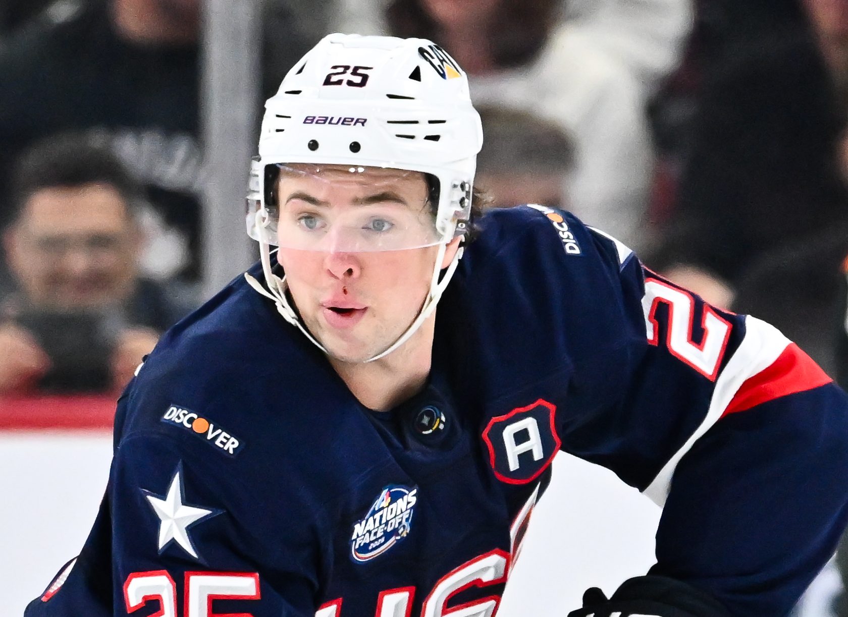 Bruins’ Charlie McAvoy Drops Huge Injury Update Before Season