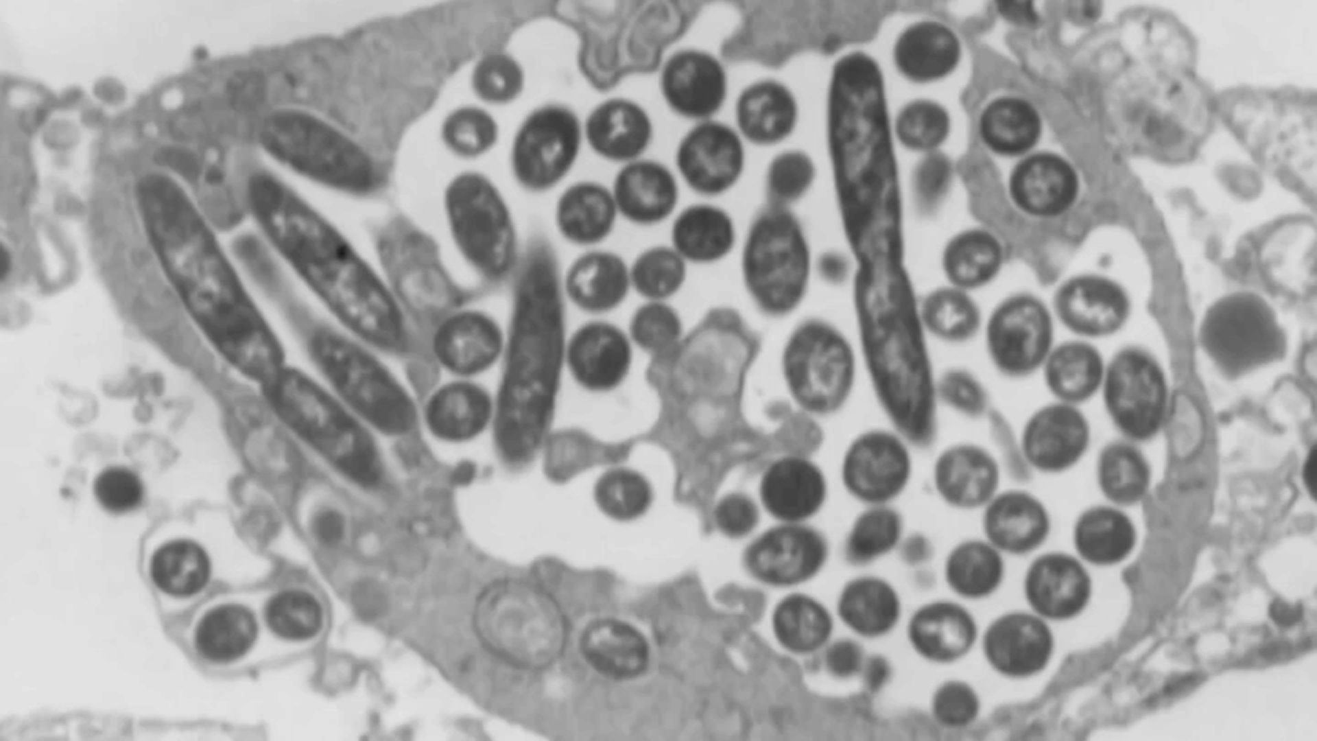 Legionnaires' disease linked to NYC's largest residential complex