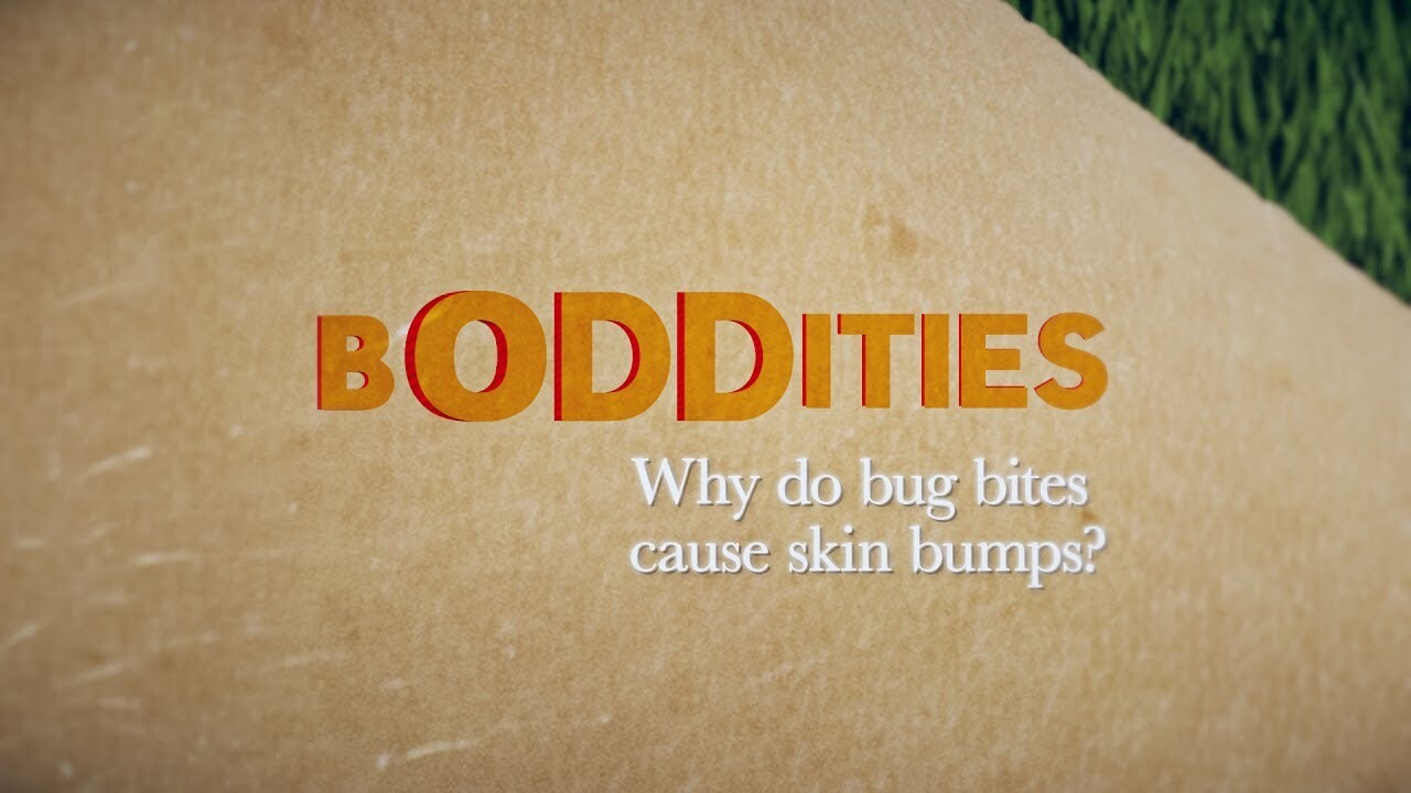 Boddities | Episode 11 | Why do bug bites cause bumps on the skin?
