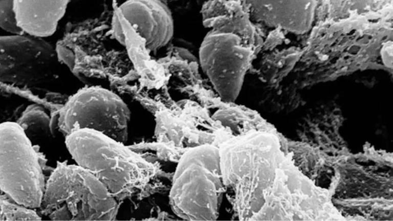 World’s first pandemic mystery solved: Scientists uncover Yersinia ...