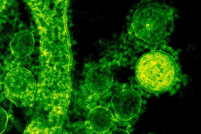 Is There a Chickenpox Outbreak? NHS Offers Free Vaccine for Children ...