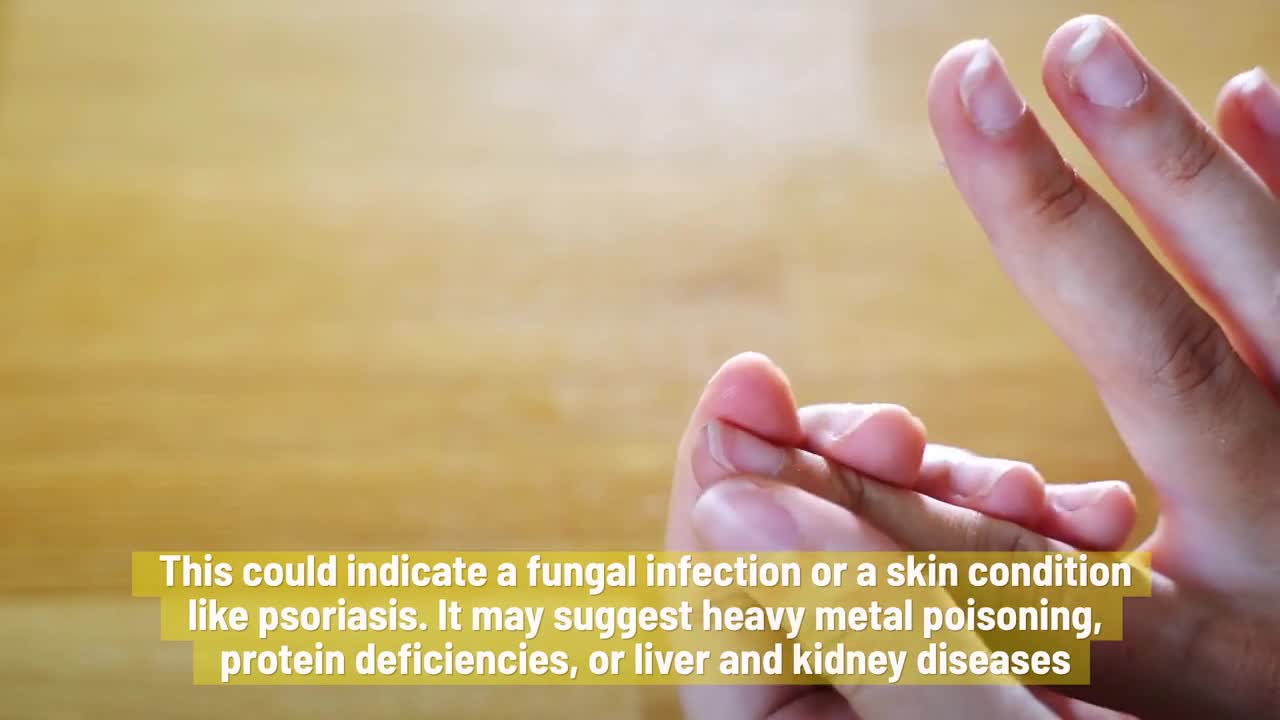What Your Nails Can Tell You About Your Health