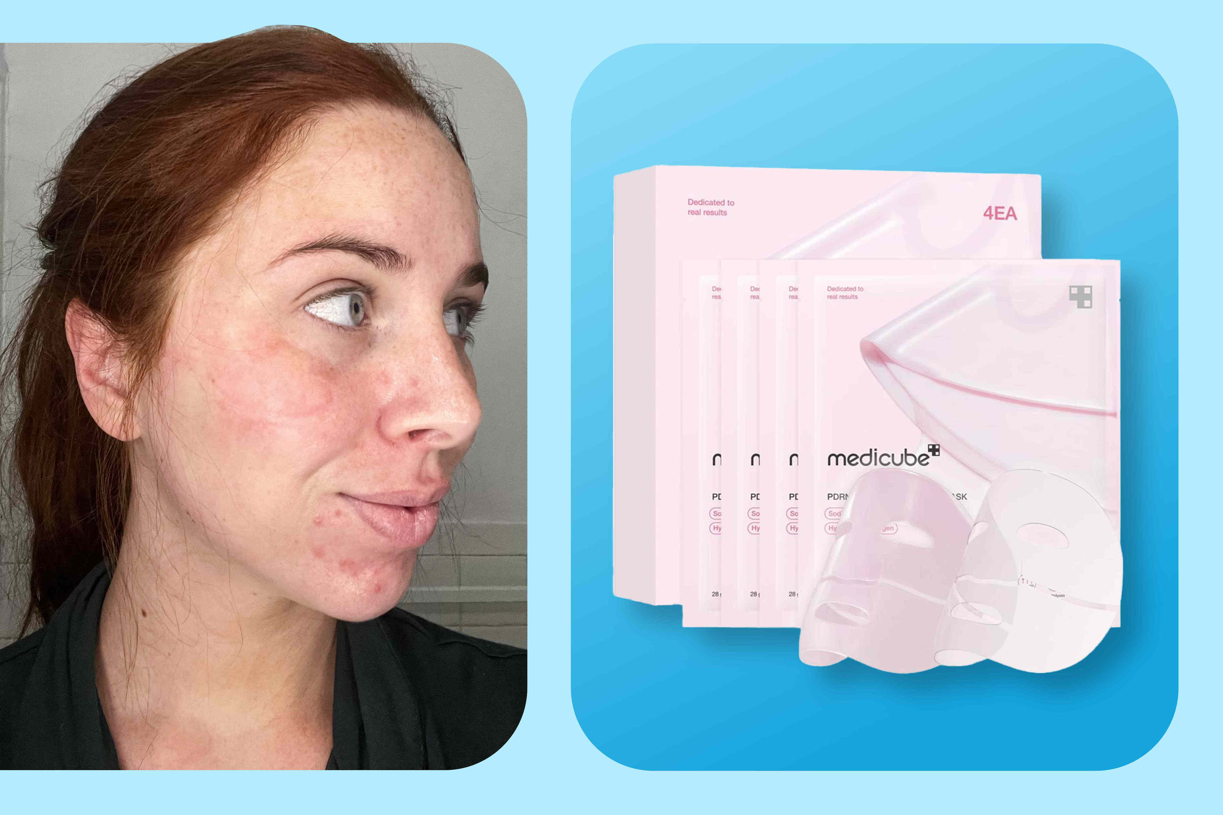 These TikTok-Viral Face Masks Are My Secret for Glowing Skin — and They ...