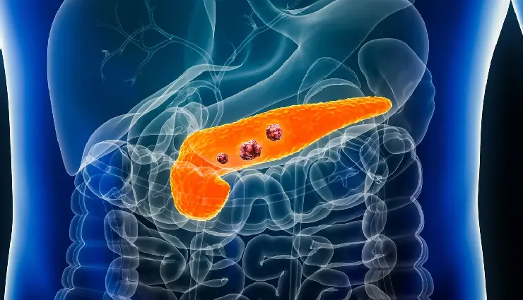 15 Major Types of Cancer You Should Know About
