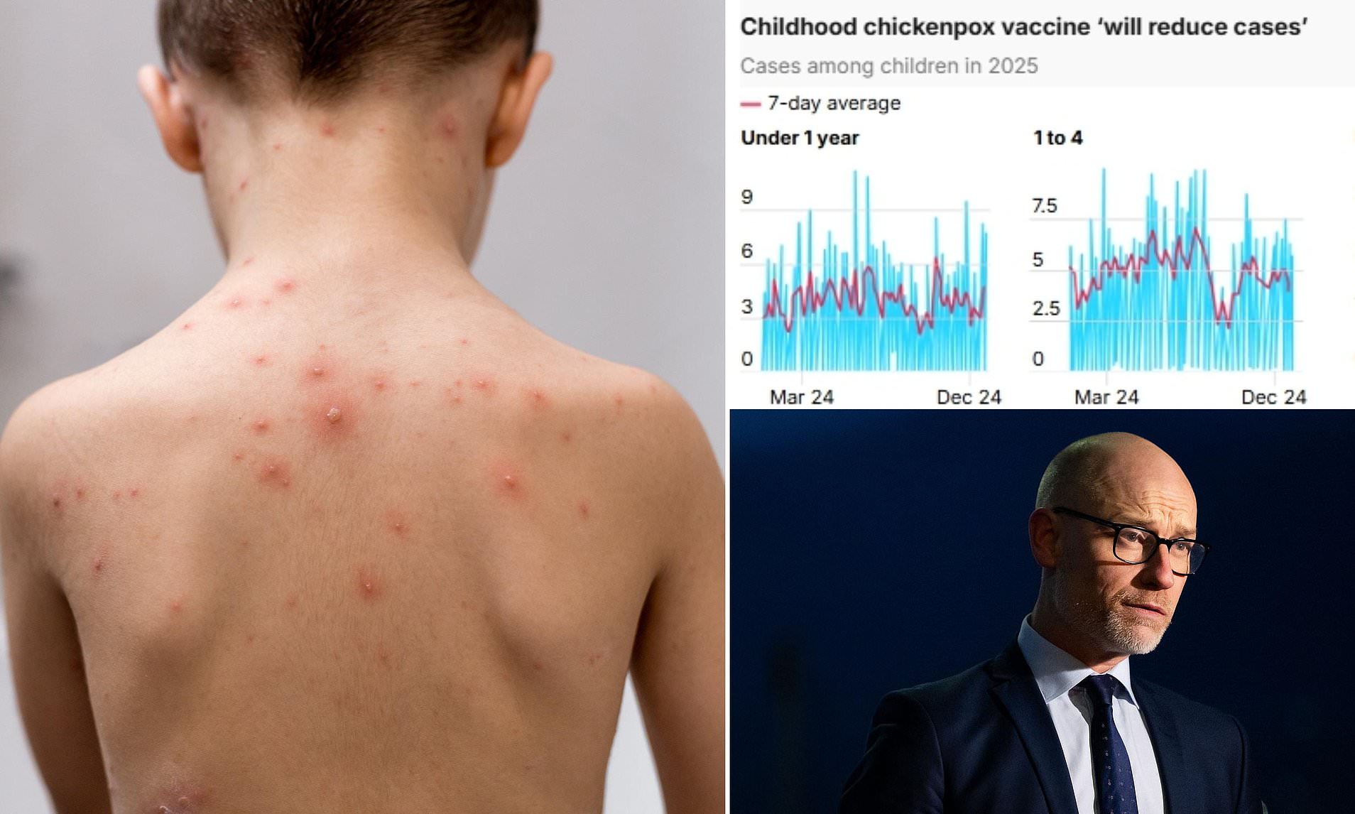 As millions of children set to get 'life saver' free chickenpox JAB ...