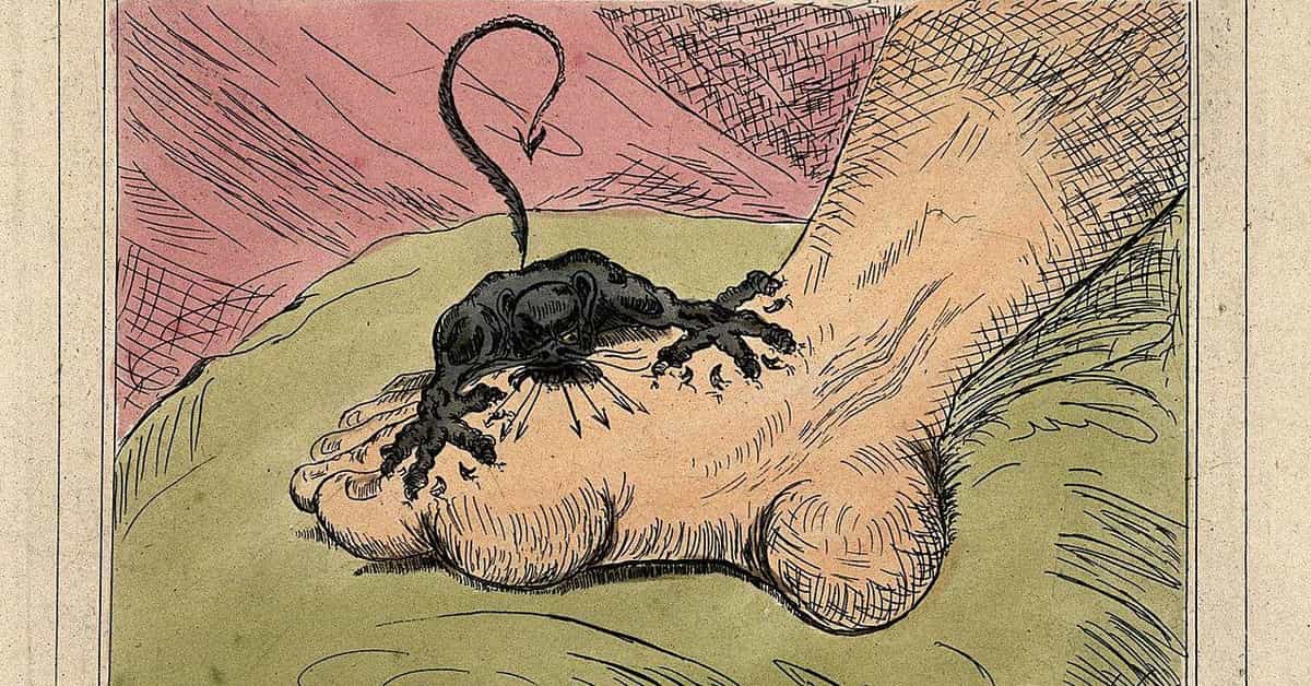 Gout, 'the Disease of Kings'