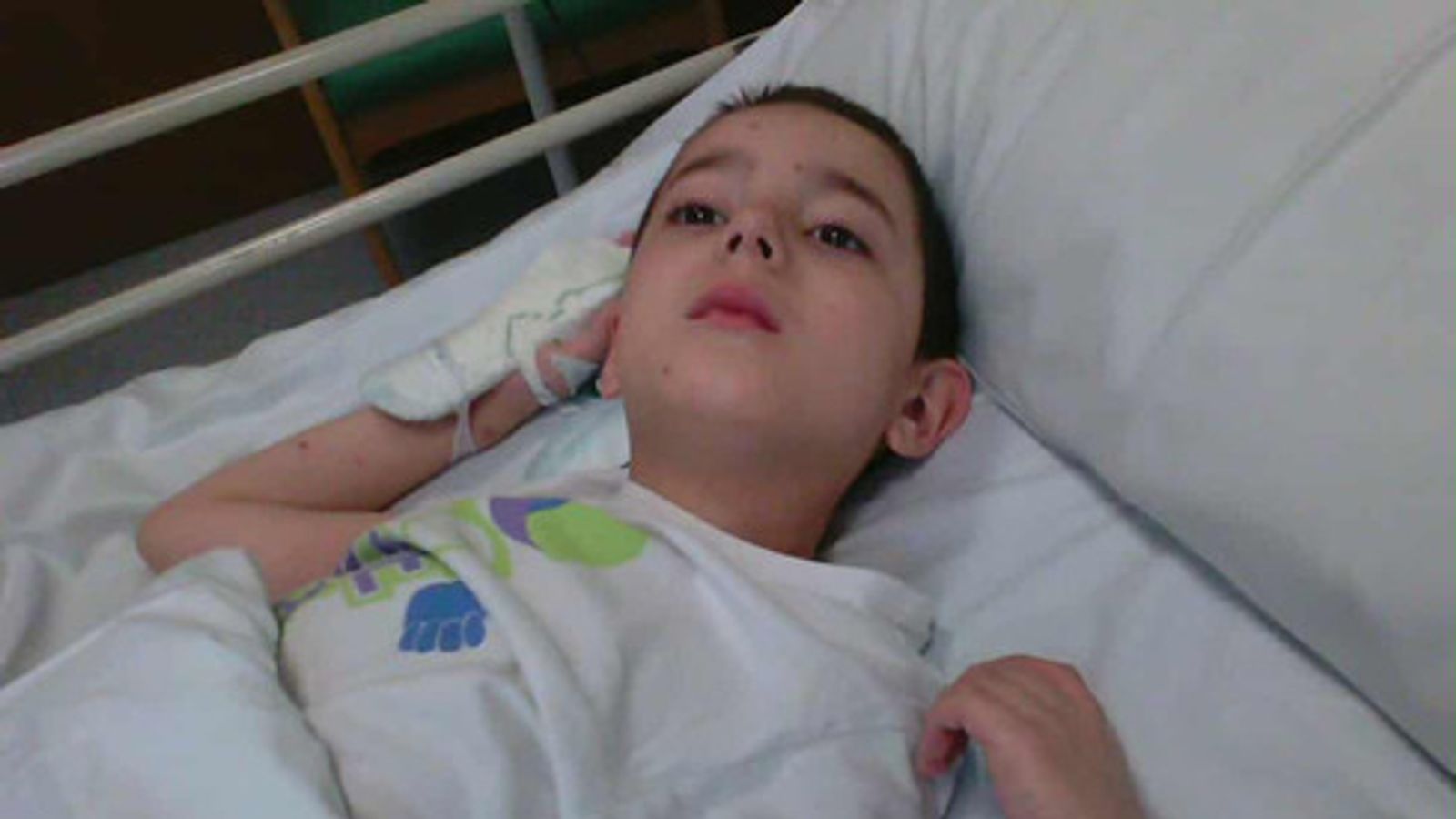 Chickenpox warning after near-death experience