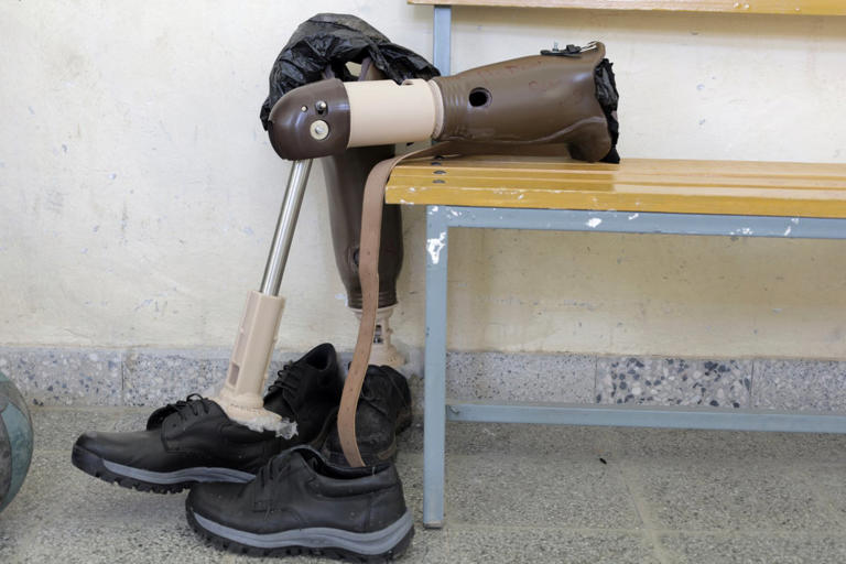 Scientists say we have been wrong about phantom limbs for decades