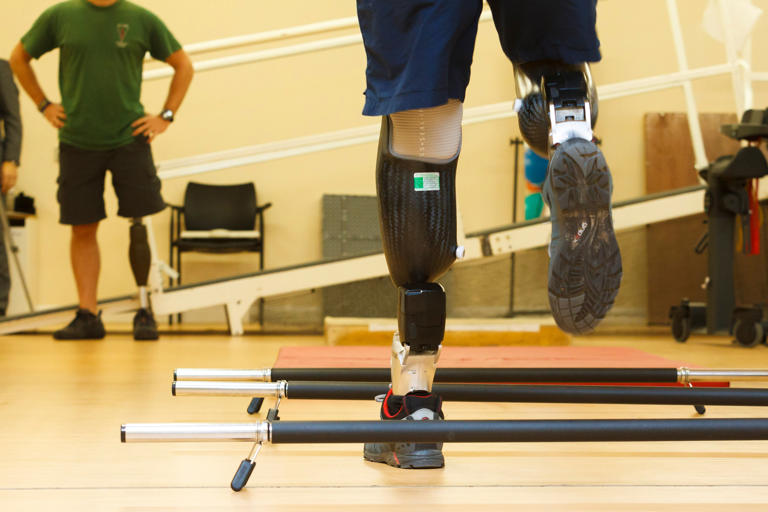Scientists say we have been wrong about phantom limbs for decades
