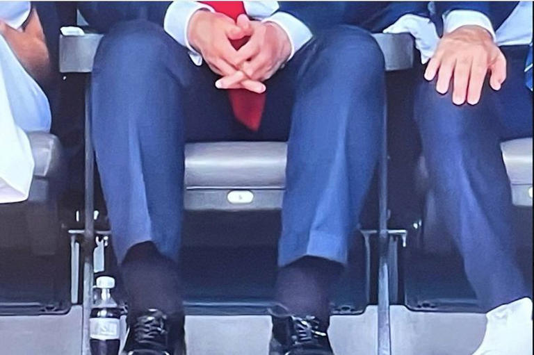 Trump warned his leg may be amputated after doctor spots chilling ...