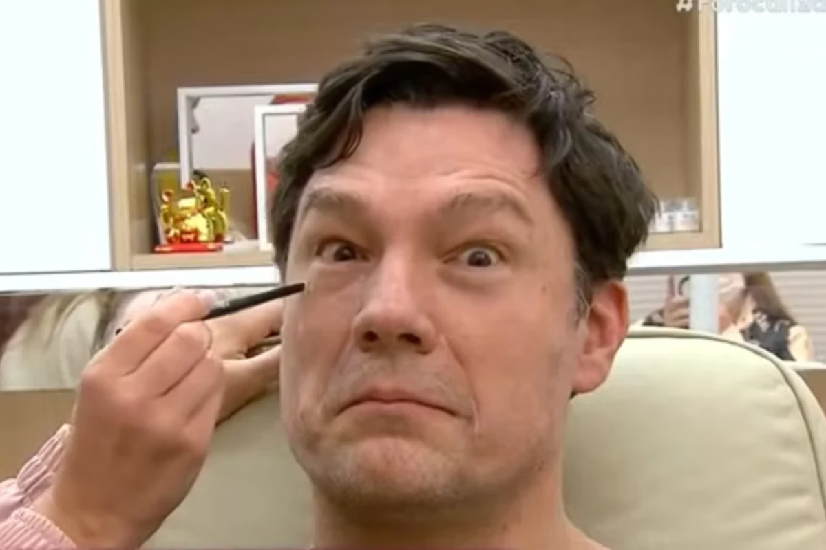 Lembra dele? Ricardo Macchi, o cigano Igor, passa por harmonização ...