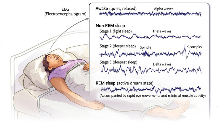 Early Risers vs. Night Owls: Neuroscientist Explains When Your Brain ...