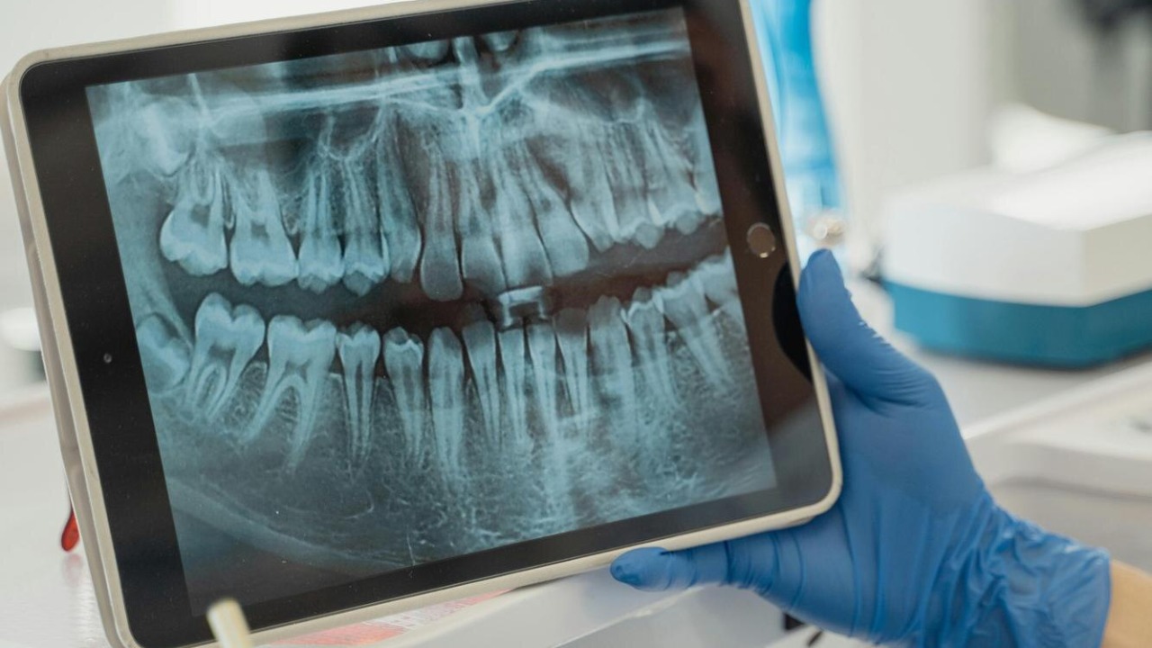 Japan begins first human trial of a tooth-regrowth drug