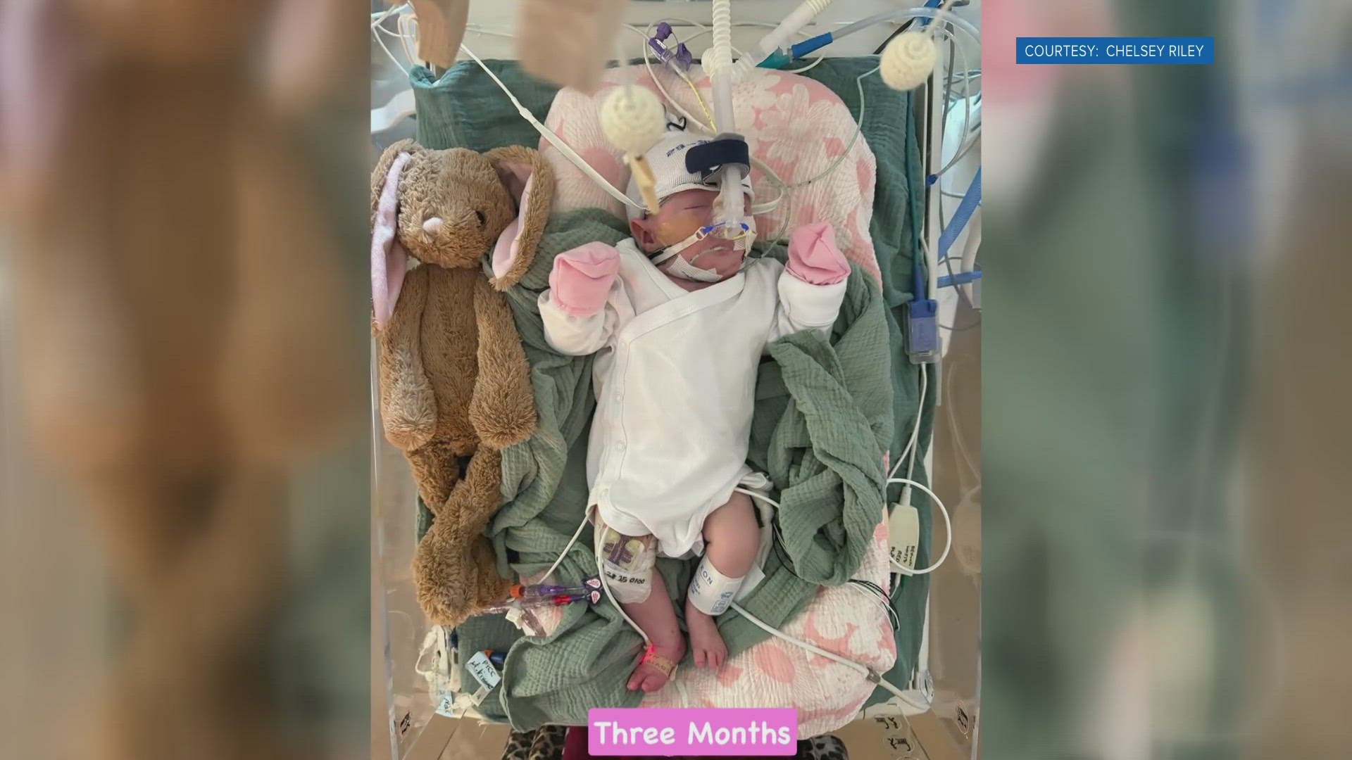 Knoxville baby born with Trisomy 18 defies odds, inspires mothers to support other parents