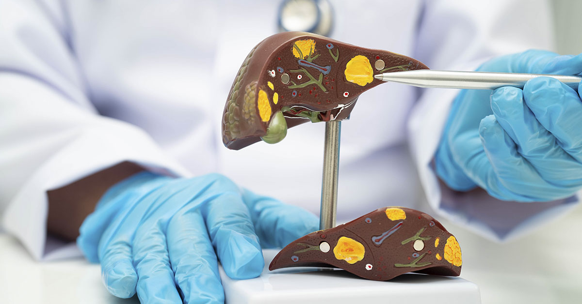 Harvard Liver Specialist Suggests Consuming 4 Snacks Weekly to Reverse ...