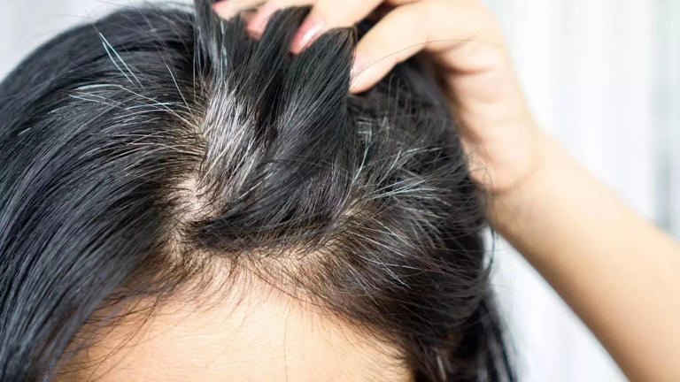 Why some people never get grey hair: Health secrets behind youthful strands