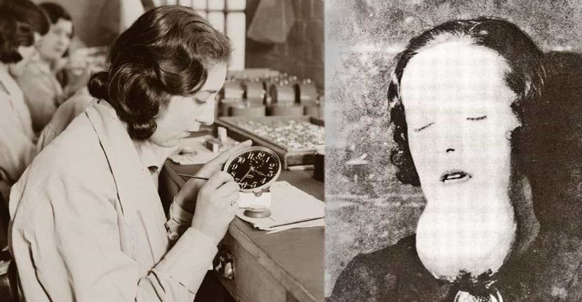 Horrific facts about radium poisoning