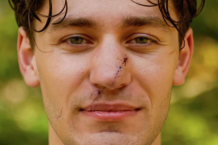 Churchill: Despite knife attack, John Rudat has no regrets