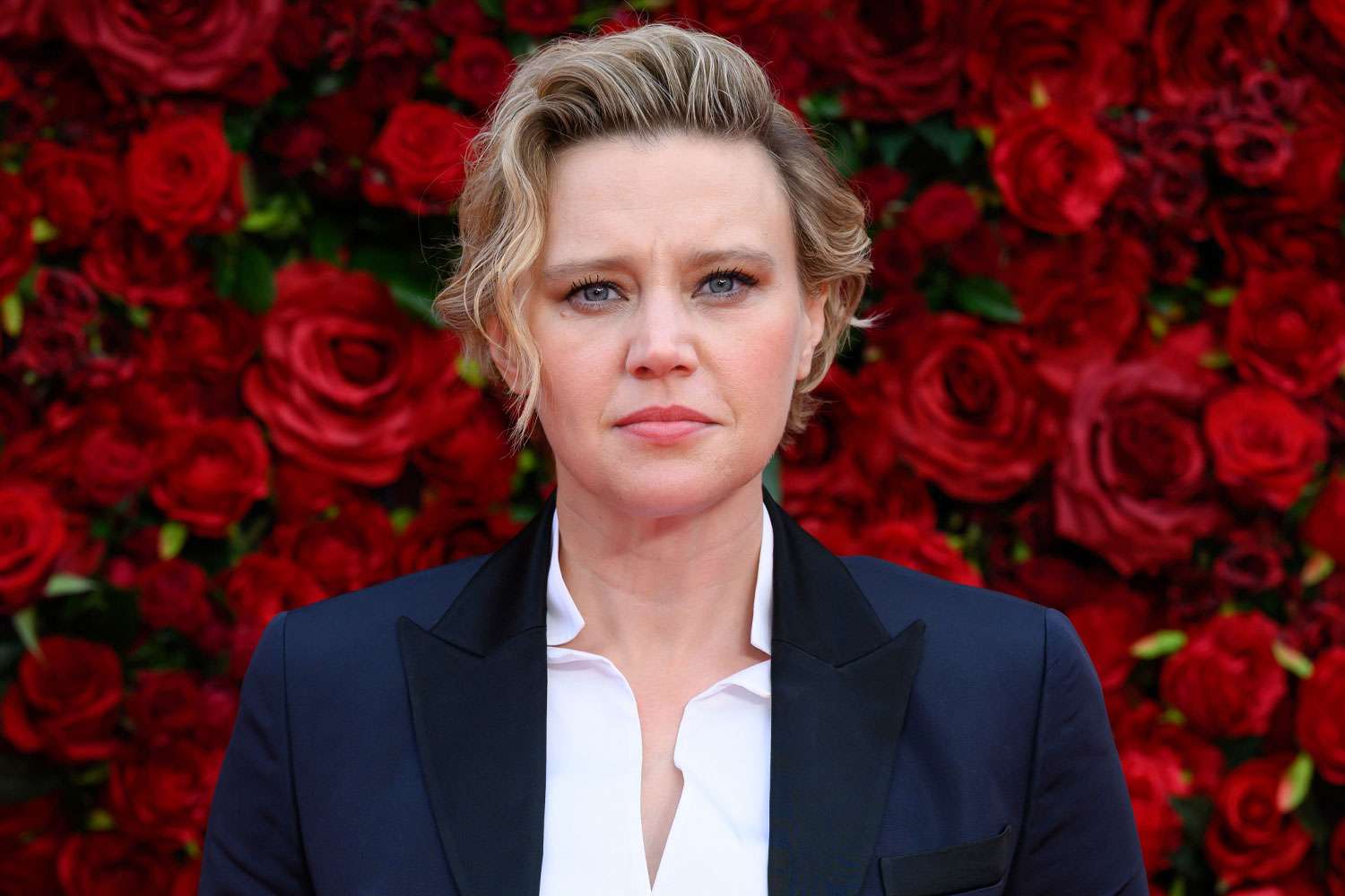 Kate McKinnon reveals she was diagnosed with geographic tongue