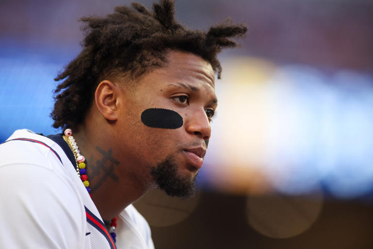 Atlanta Braves' Ronald Acuna Jr. Decision Makes Absolutely No Sense