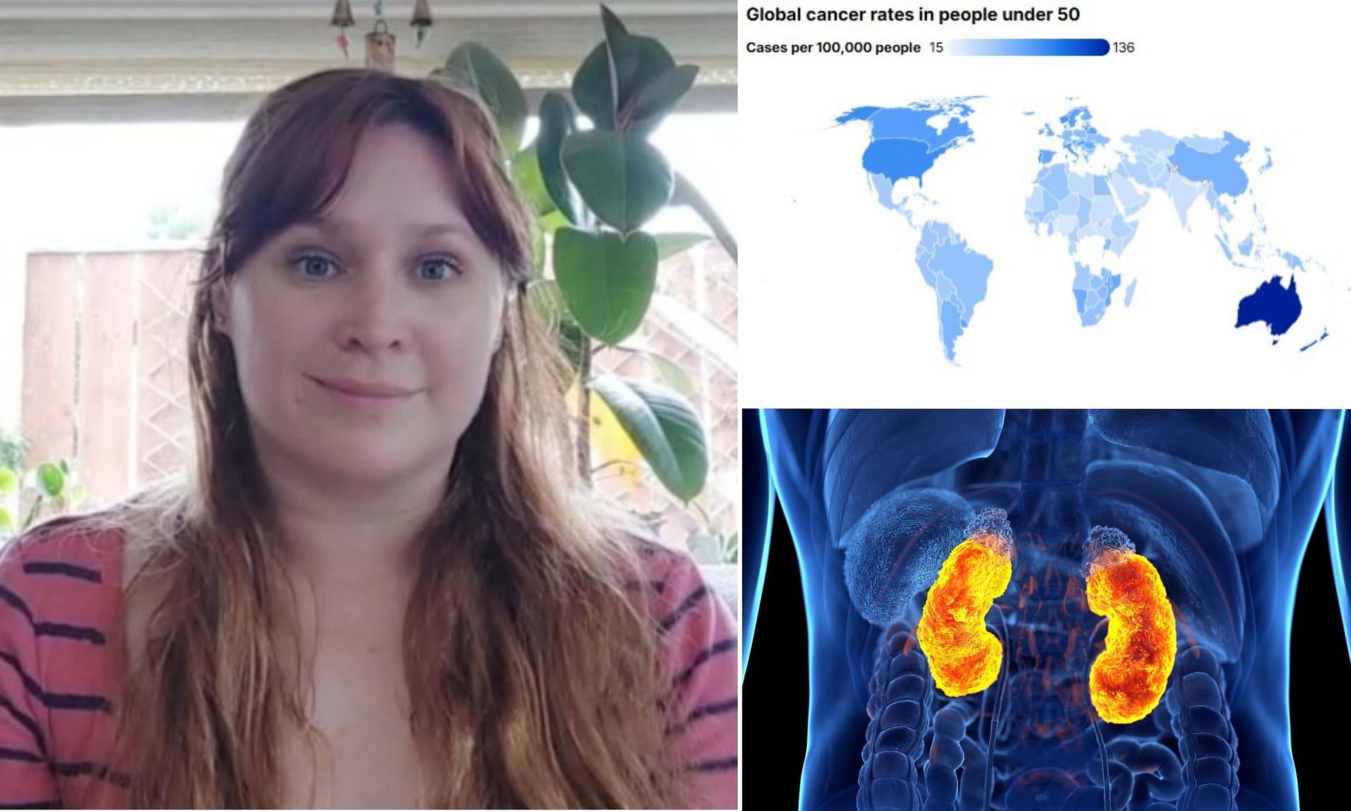 Expert reveals the six little-known signs of 'silent cancer' that is ...