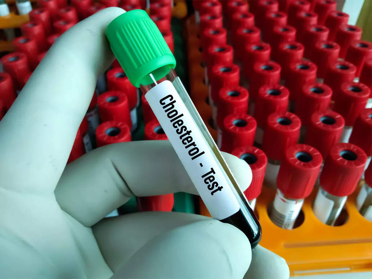 Blood vs brain cholesterol: What's good, what's risky, and why age matters