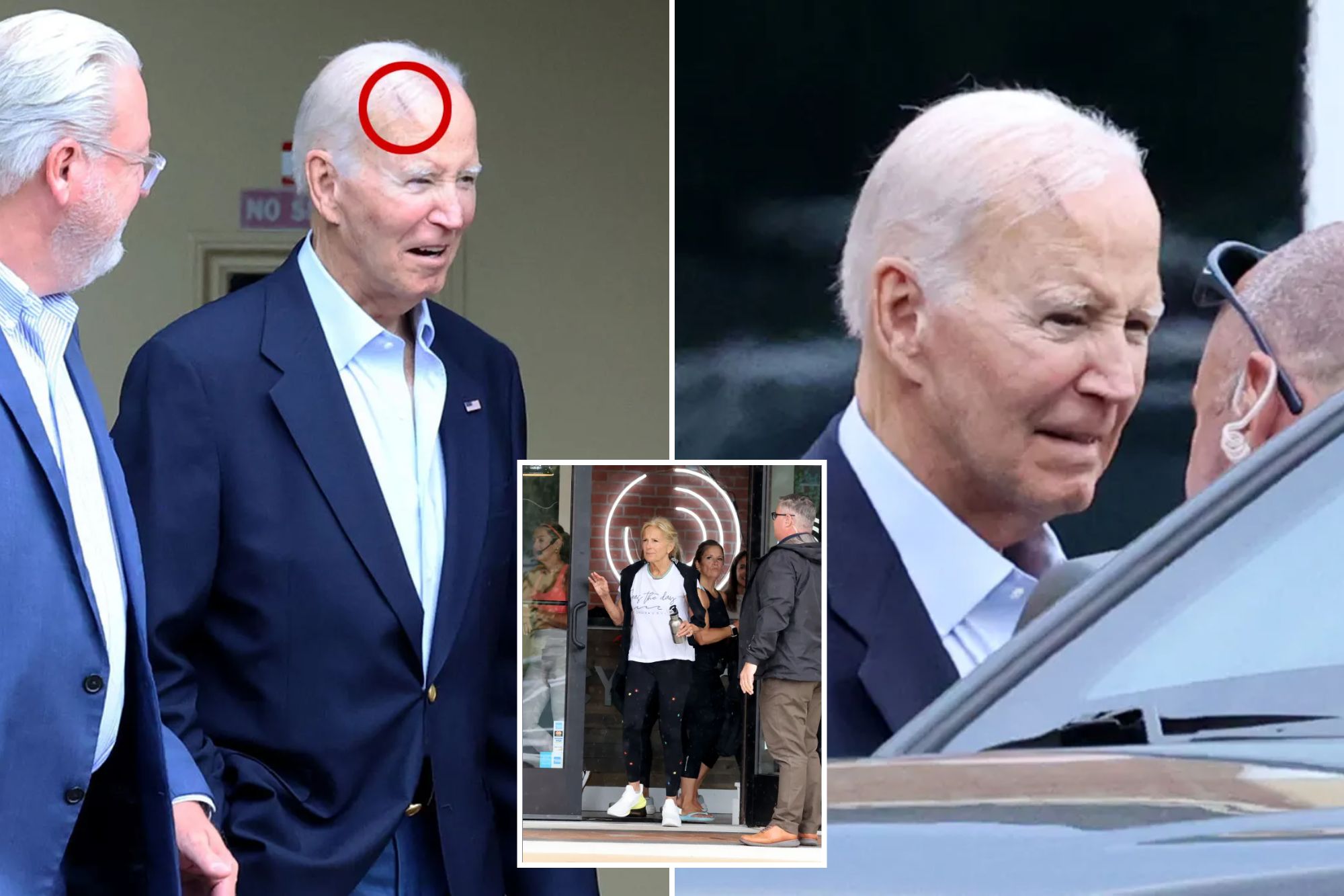 Biden, 82, spotted with massive scar on his head after getting skin ...