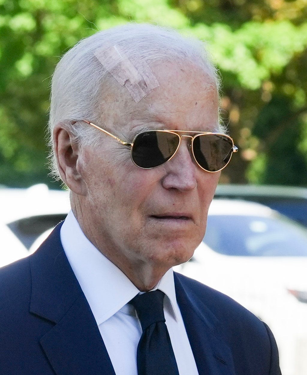 Biden, 82, spotted with massive scar on his head after getting skin ...