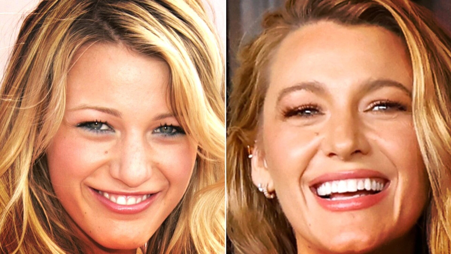 Stars Whose Careers Took Off After Cosmetic Surgery